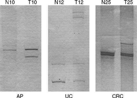 Representative Gels Of Single Strand Conformational Polymorphism With Download Scientific