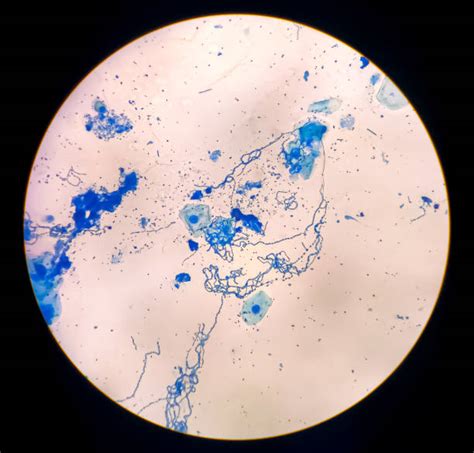 420 Streptococcus Lactis Cremoris Fotos Fotos De Stock Imagens E Fotos Royalty Free Istock