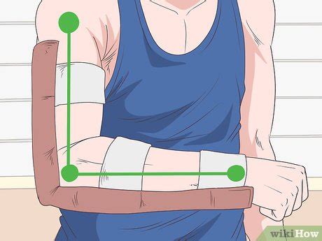 Coaptation Splint For Humerus Fracture