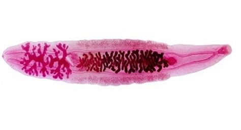 Parasitic Worms In Human Skin About Clonorchis Liver Flukes Cdc