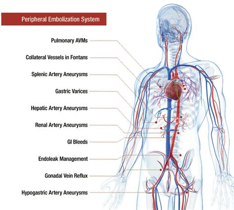 Penumbra Embolization Platform A Coil For Every Case Endovascular Today