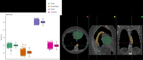 Evaluation Of The Sphericity Radiomics Features From The Ai Generated Download Scientific