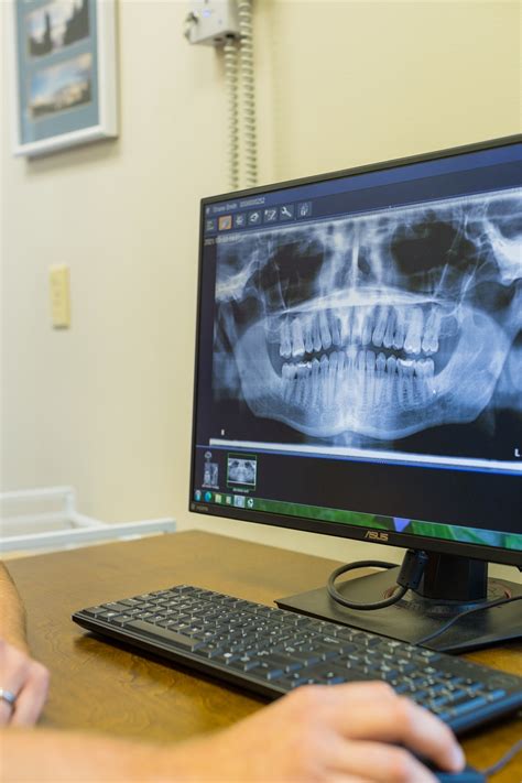 Digital Radiographs Dentagama