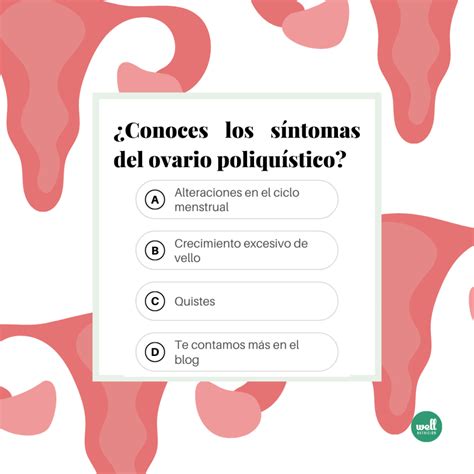 Síntomas Del Ovario Poliquístico O Sop Well Nutrición