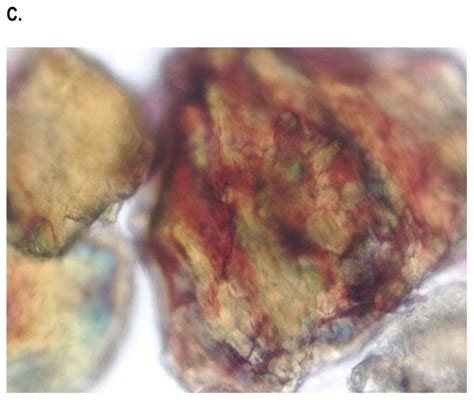 Osteoconductivity And Osteoinductivity Of Nanofuse® Dbm Pmc