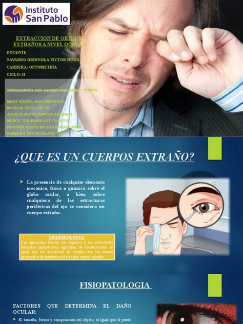 Extraccion De Cuerpos Extraños Pdf Ojo Córnea