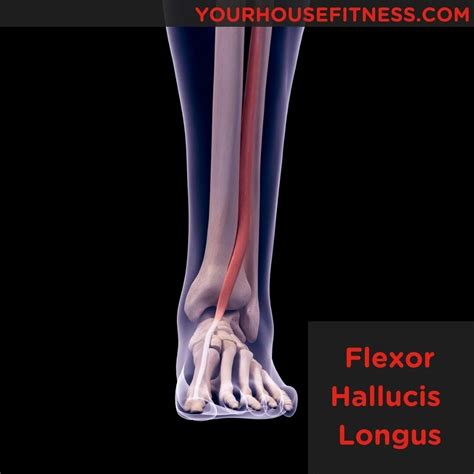 Flexor Hallucis Longus Tendon Repair Of Iatrogenic Rupture Of The