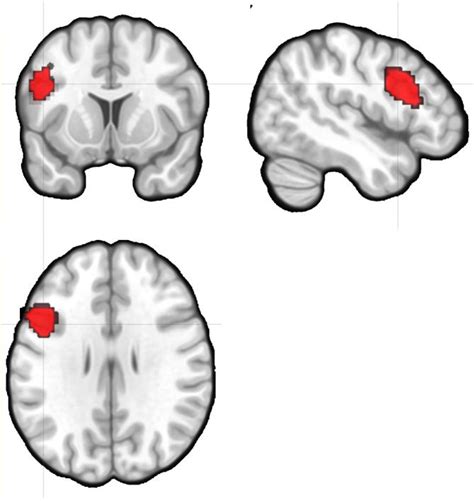 Conjunction Analysis Results Download Scientific Diagram