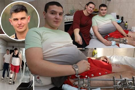 Uzeo Nam Je Sve A Smeje Nam Se U Lice I LaŽe Majka Ranjenog Mladića Iz Malog Orašja Jedva Čeka