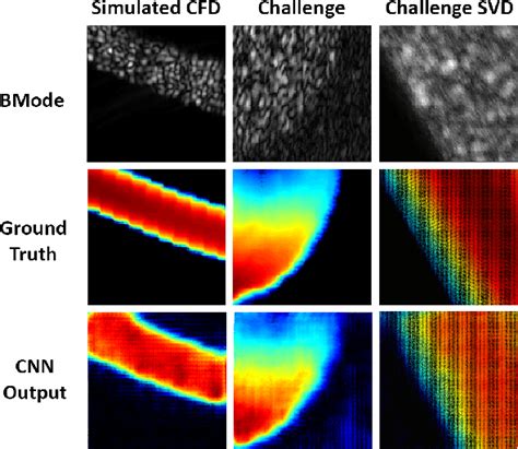 Demonstration Of Vector Flow Imaging Using Convolutional Neural