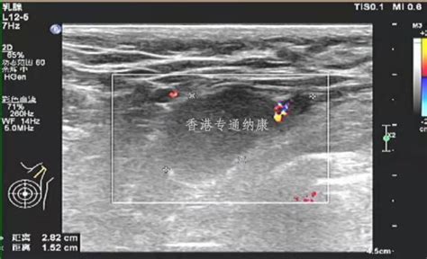 Ds 8201德喜曲妥珠单抗香港上市版本中文说明书同译文财富号东方财富网