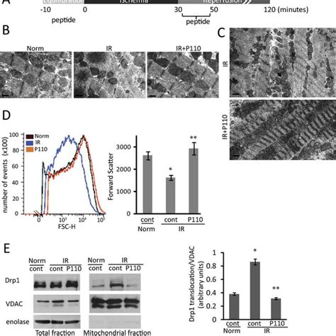 Mitochondrial Fragmentation And Function In Cardiac Myocytes Under Iro Download Scientific