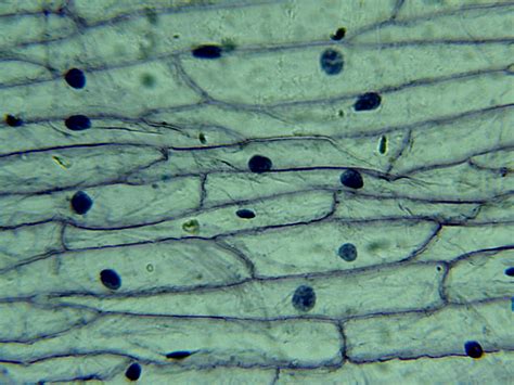 Onion Skin Cells Under Microscope Vrogue Co