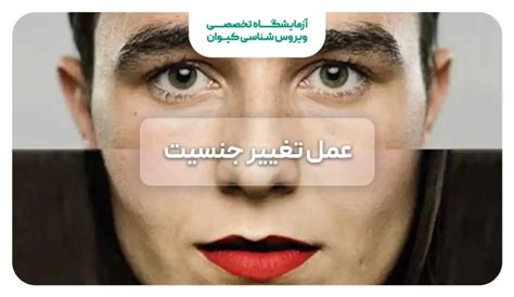 حقایق شگفت انگیز درباره عمل تغییر جنسیت مجله سلامت کیوان