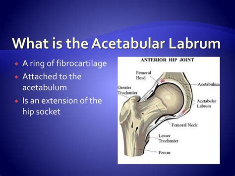 Ppt Diagnosis And Treatment Of Acetabular Labrum Tears Powerpoint Presentation Id 3324497