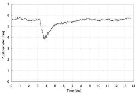 Measurement Result Of Pupil Diameter In Pupillary Light Reaction Download Scientific Diagram