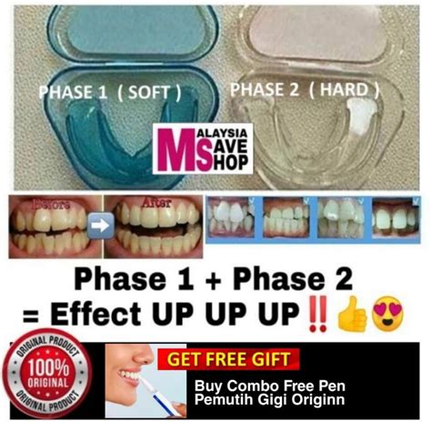Ready Stockcombo Teeth Trainer Alingmentteeth Bracespendakap Gigi
