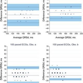 Measurement Of QRS Duration In Paced And Intrinsic Rhythm Download Scientific Diagram