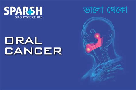 Oral Cancer Sparsh Diagnostic Center