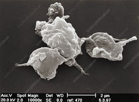 Platelets Sem Stock Image P256 0048 Science Photo Library