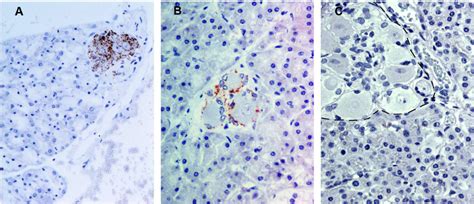 Immunohistochemical Detection Of Prp Sc In Pancreas Using L42 Prp