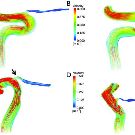 The Streamlines Are Colored According To The Magnitude Of Velocity In