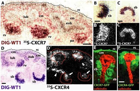 A D A Digoxigenin Dig Labeled Wt1 Antisense Probe Was Used As A Download Scientific Diagram