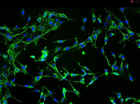 Human Aortic Adventitial Fibroblasts Haaf