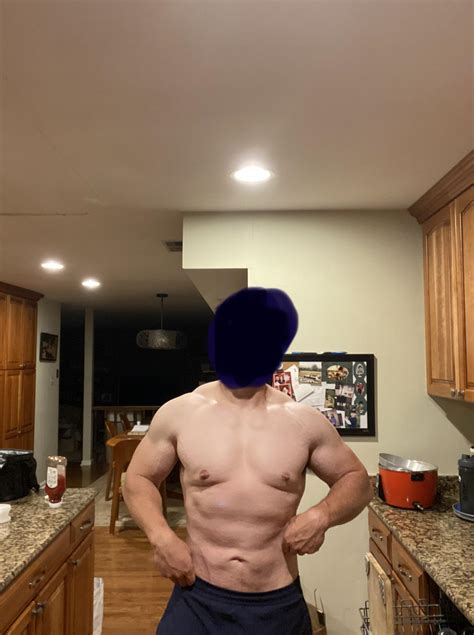 Does Such A Procedure Exist Rcosmeticsurgery