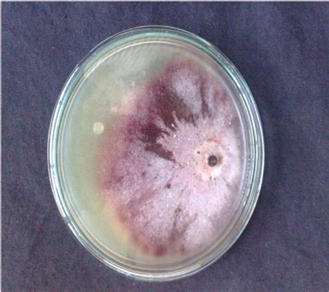 Dual Culture Showing Competition For Space And Nutrients Between The