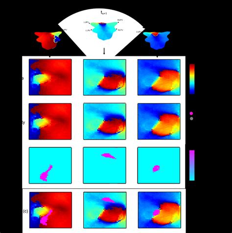 Illustration Of The Parameters Characterising The Atrial Substrate For Download Scientific