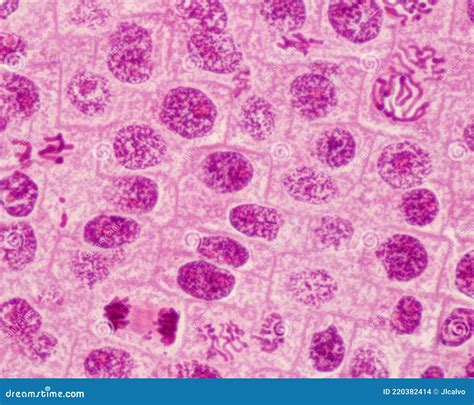 Anaphase Under Microscope