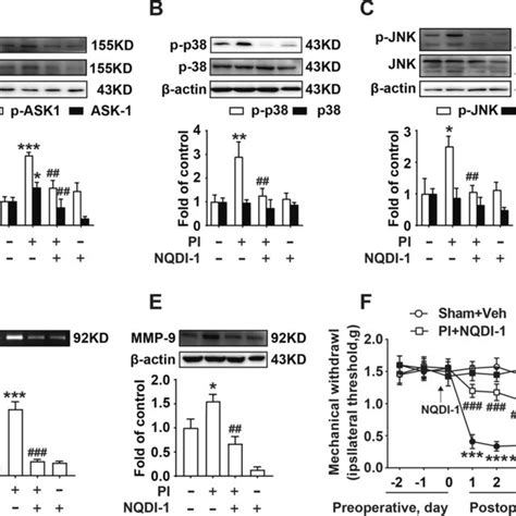 Ask1 Inhibition Decreased Mmp 9 Activity And Attenuated Postoperative Download Scientific
