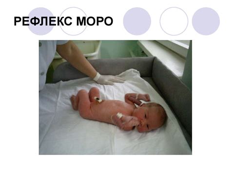 Рефлексы новорожденных презентация онлайн