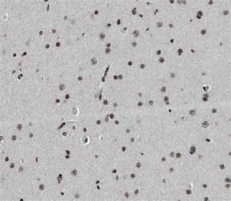 Pproex Hta [pvt0373]