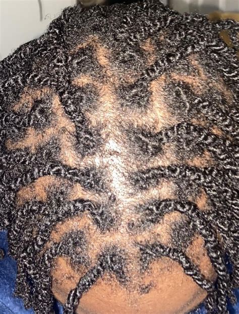 6 Months Locd Rlocs