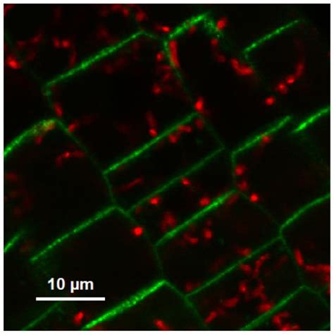 Picoquant On Linkedin Fluorescence Microscopy Spectroscopy Flim Imaging Fcs Fret…
