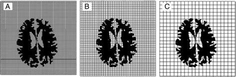 Example Of Fd Estimation For Cerebral White Matter Using Box Counting Download Scientific