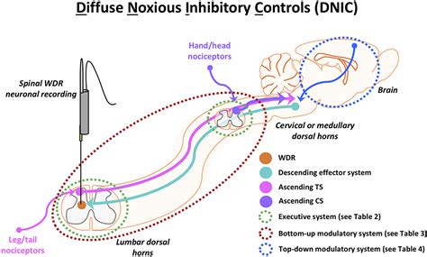Understanding Diffuse Noxious Inhibitory Controls Jpr Jpr