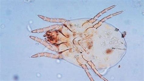 Scientists Find Deadly Scrub Typhus Bacteria In South America