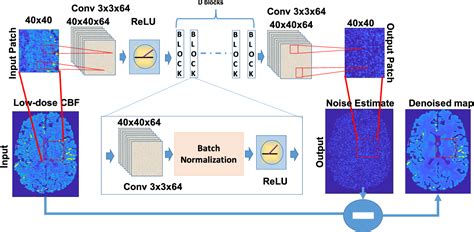 figure 2 from convolutional neural network based robust denoising of