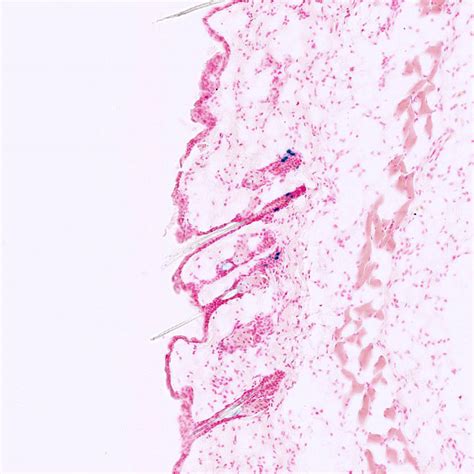 Lgr5 Integumental System Recombinase Activity Detail Mgi Mouse