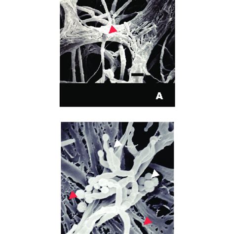 Pdf Mode Of Action Of Trichoderma Asperellum Skt 1 A Biocontrol