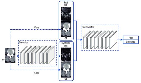 Flow Diagram Of The Deep Generative Adversarial Networks Gans Ct Download Scientific