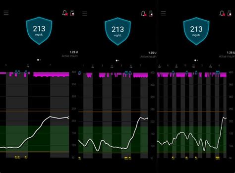Understanding Your CGM Data The Ups Downs And Realistic Expectations Of Diabetes Management