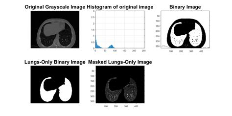 Image Preprocessing And Segmentation Of The Lung Download Scientific Diagram