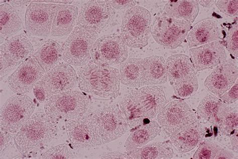 Mitosis Cell In The Root Tip Of Onion Under A Microscope Stock Photo Image Of Haploid