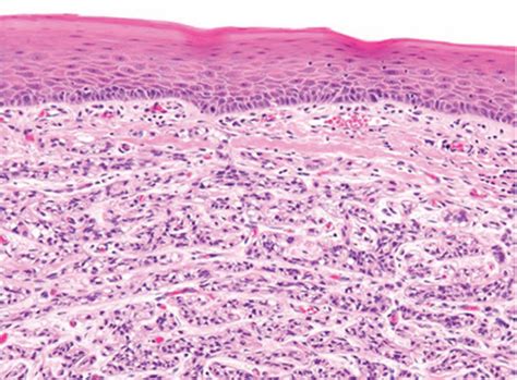 Microscopic And Survey View Of The Surgical Resected Specimen A Download Scientific Diagram