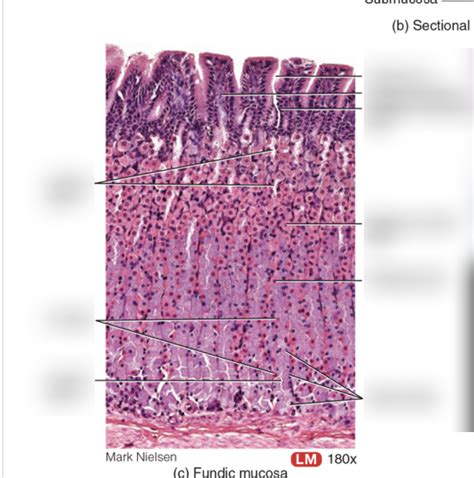 Better Gastric Shtuffies Diagram Quizlet