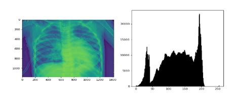 histogram of pixel intensities download scientific diagram